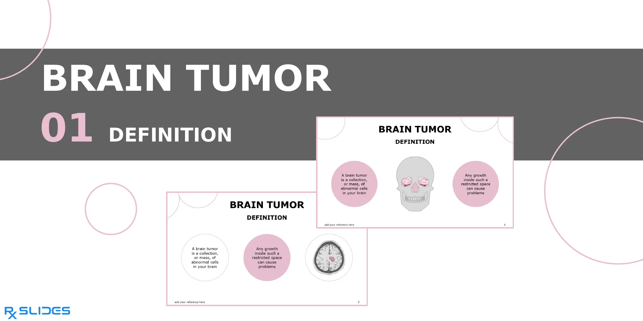 Download Brain Tumor PowerPoint Template| RxSlides